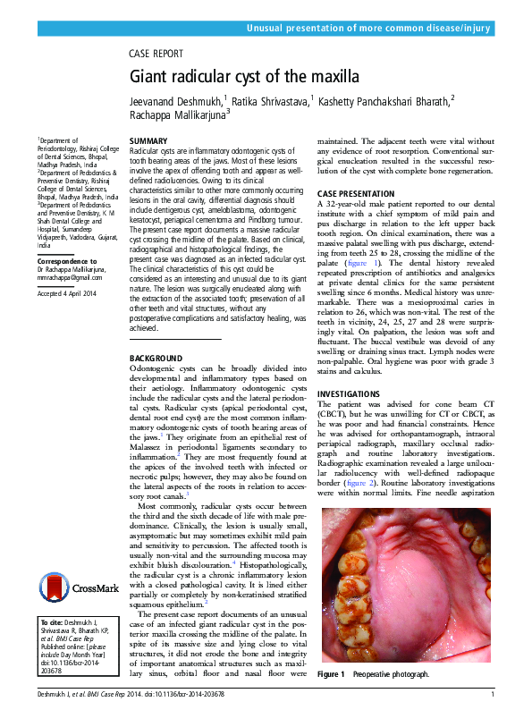 (PDF) Giant radicular cyst of the maxilla