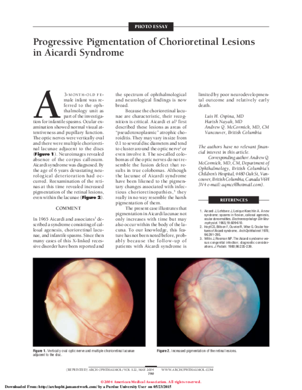 (PDF) Progressive Pigmentation of Chorioretinal Lesions in Aicardi Syndrome