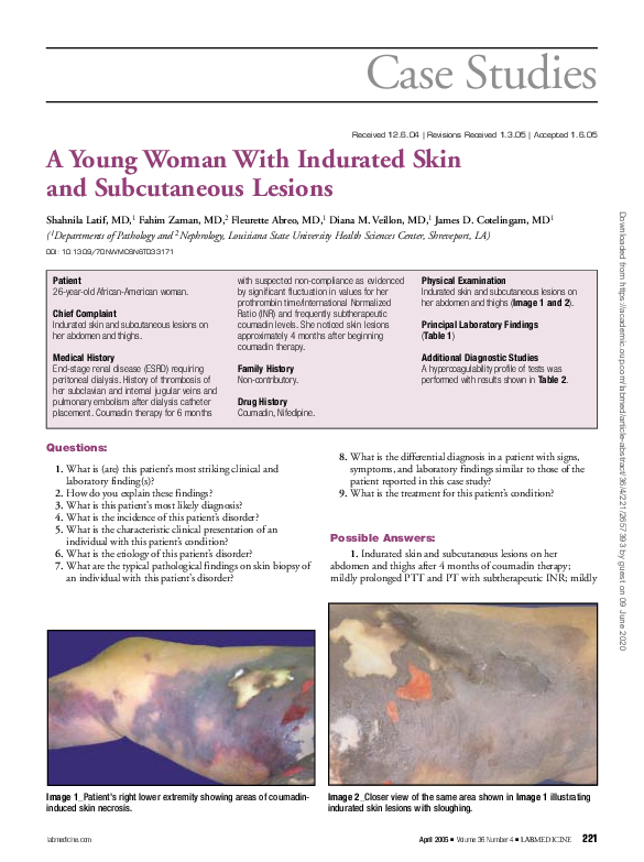 (PDF) A Young Woman With Indurated Skin and Subcutaneous Lesions