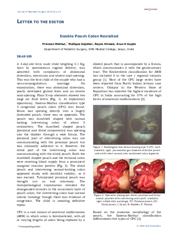 (PDF) Double Pouch Colon Revisited