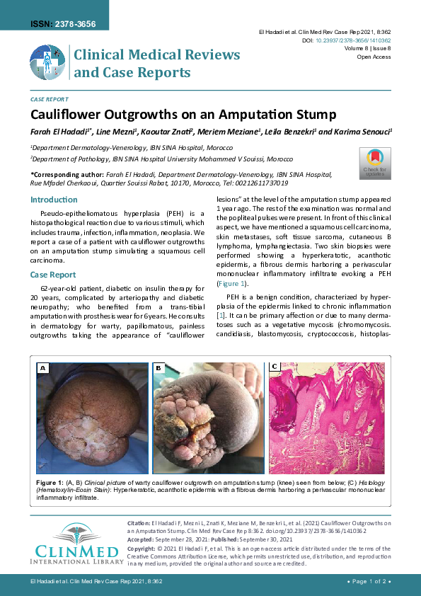 (PDF) Cauliflower Outgrowths on an Amputation Stump