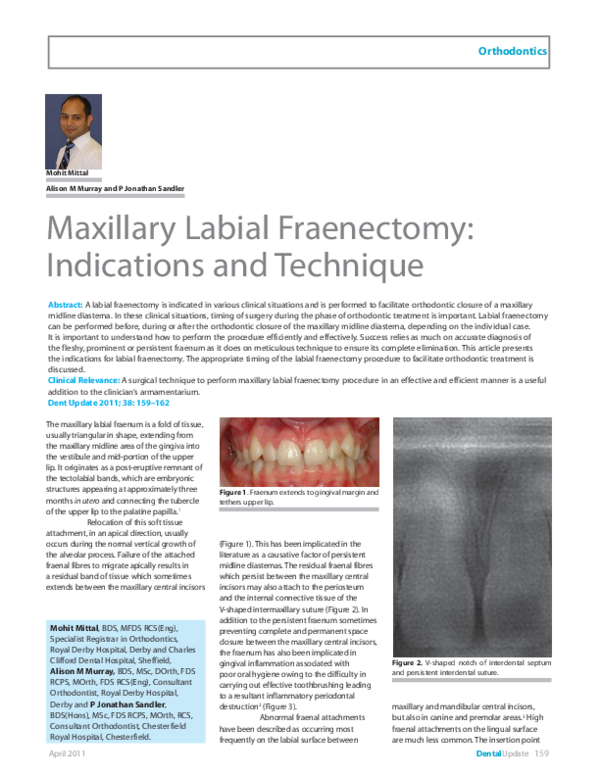 (PDF) Maxillary labial fraenectomy: indications and technique