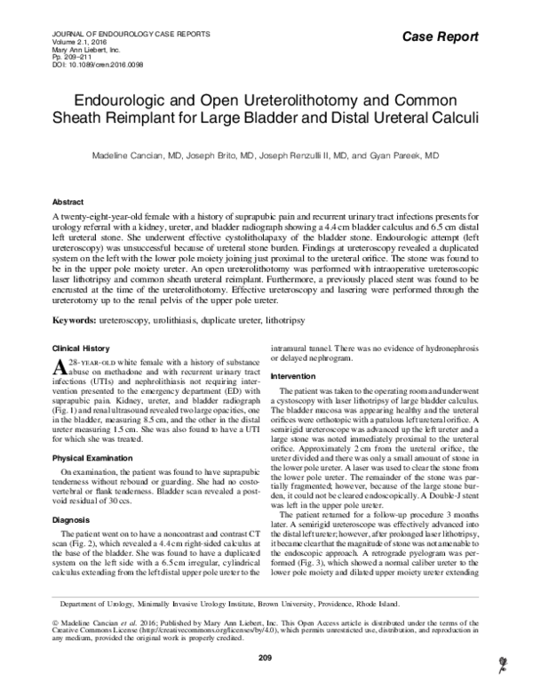 (PDF) Endourologic and Open Ureterolithotomy and Common Sheath ...