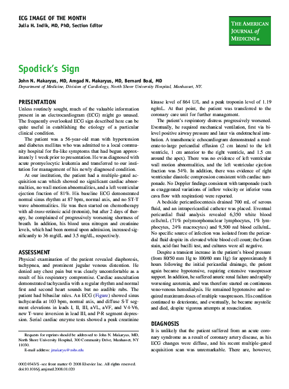 (PDF) Spodick's Sign | Bernard Boal - Academia.edu