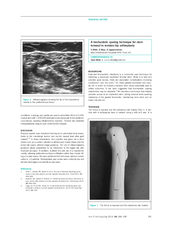 (PDF) A trochanteric sparing technique for stem removal in revision hip ...