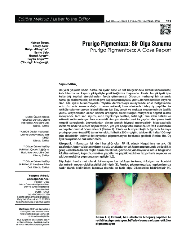 (PDF) Prurigo Pigmentoza: Bir Olgu Sunumu