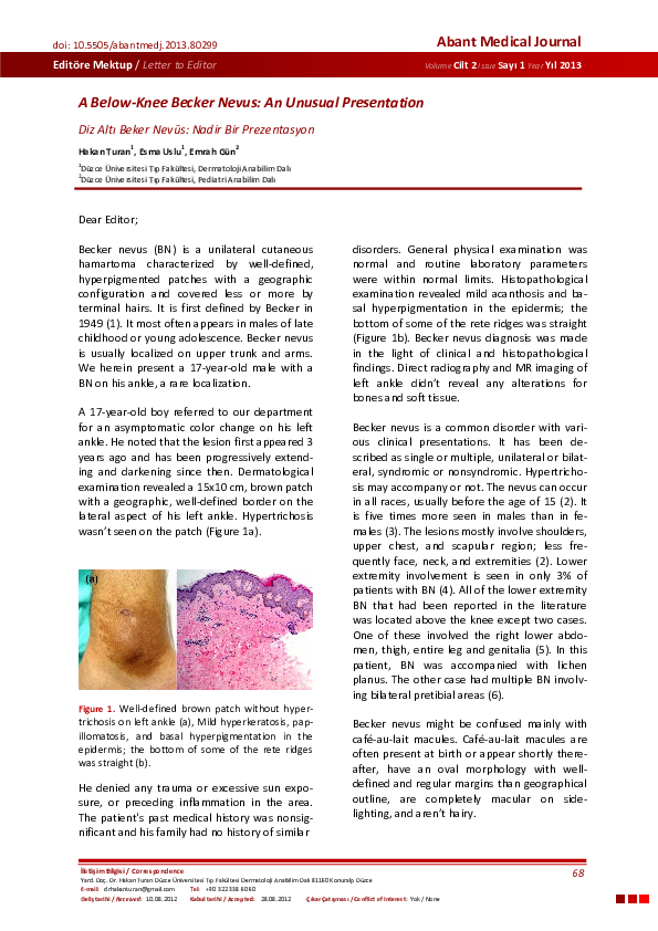 (PDF) A Below-Knee Becker Nevus: An Unusual Presentation