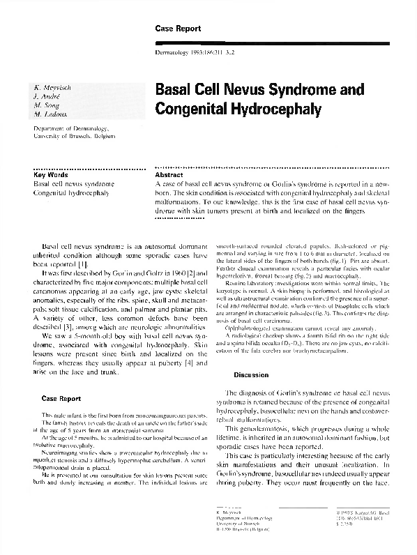 (PDF) Basal Cell Nevus Syndrome and Congenital Hydrocephaly