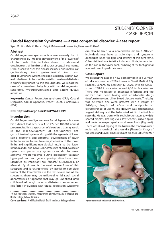 (PDF) Caudal Regression Syndrome— a rare congenital disorder: a case report
