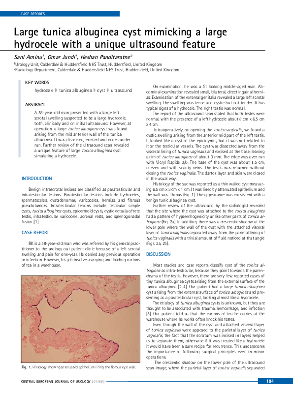 (PDF) Large tunica albuginea cyst mimicking a large hydrocele with a ...