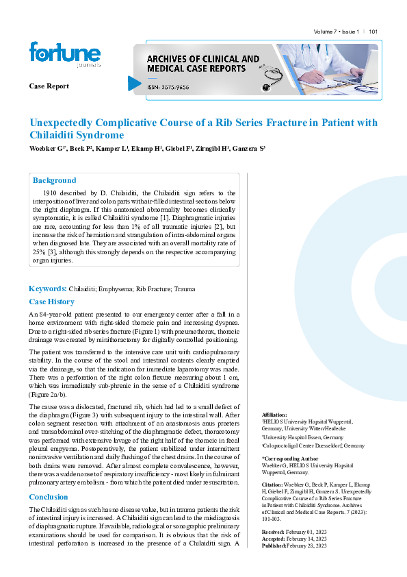 (PDF) Unexpectedly Complicative Course of a Rib Series Fracture in ...