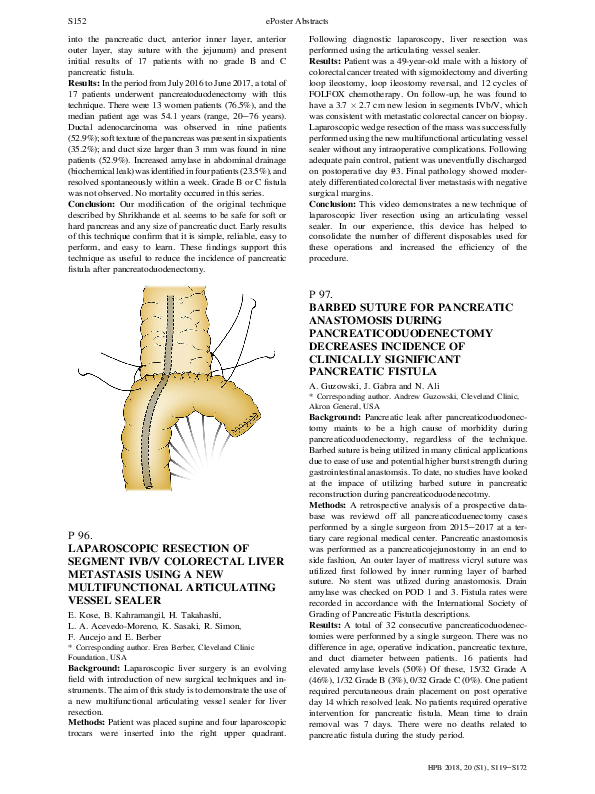 (PDF) Laparoscopic resection of segment IVB/V colorectal liver ...