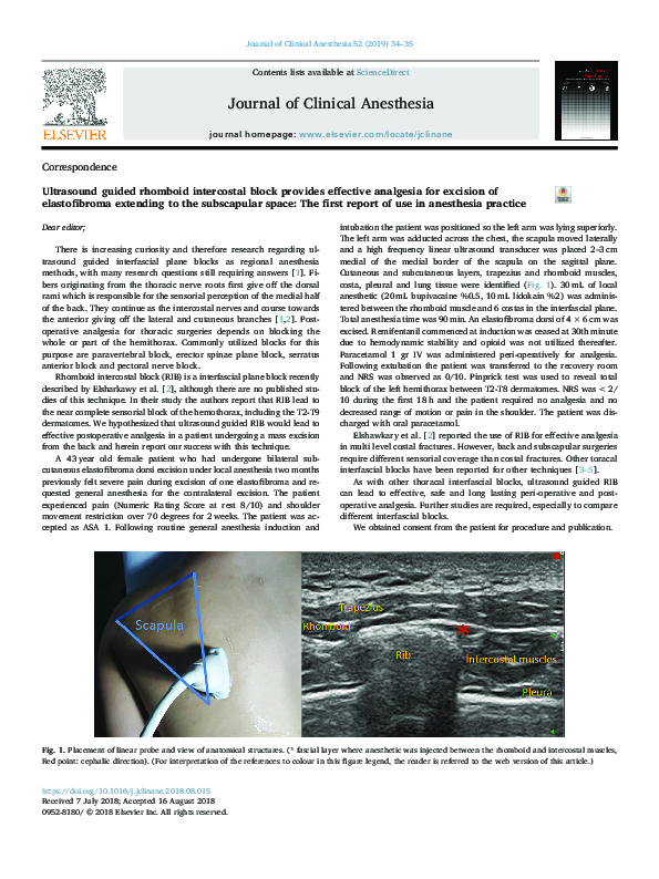 (PDF) Ultrasound guided rhomboid intercostal block provides effective ...
