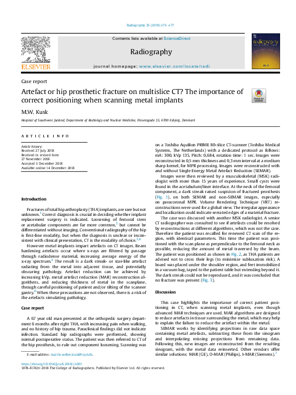 (PDF) Artefact or hip prosthetic fracture on multislice CT? The ...