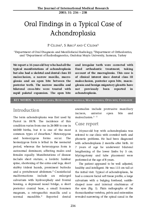 (PDF) Oral Findings in a Typical Case of Achondroplasia