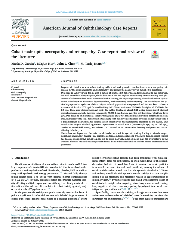 Cobalt toxic optic neuropathy and retinopathy: Case report and review of the literature