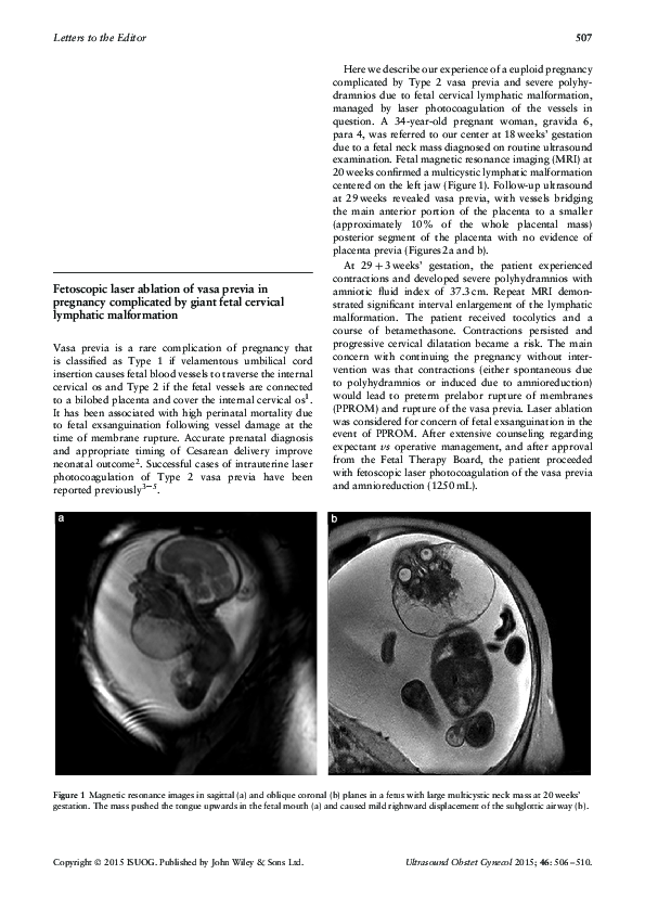 (PDF) Fetoscopic laser ablation of vasa previa for a fetus with a giant ...