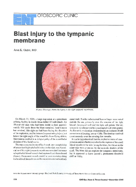 (PDF) Blast Injury to the Tympanic Membrane