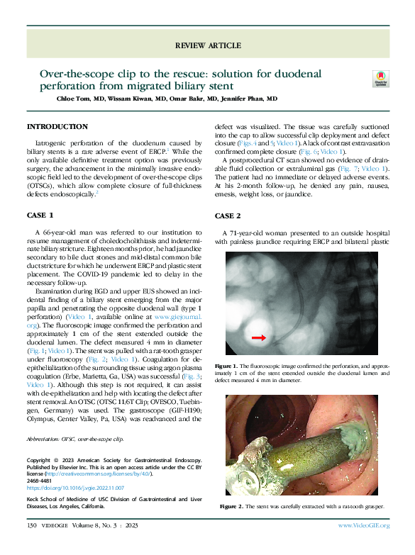 (PDF) Over-the-scope clip to the rescue: solution for duodenal ...