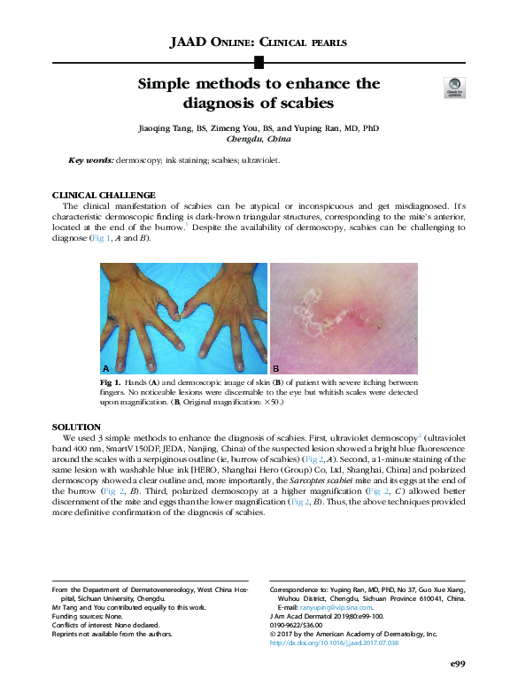 (PDF) Simple methods to enhance the diagnosis of scabies