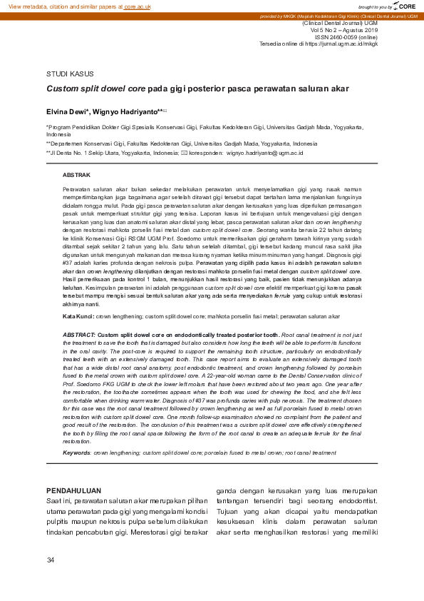 (PDF) Custom split dowel core pada gigi posterior pasca perawatan ...