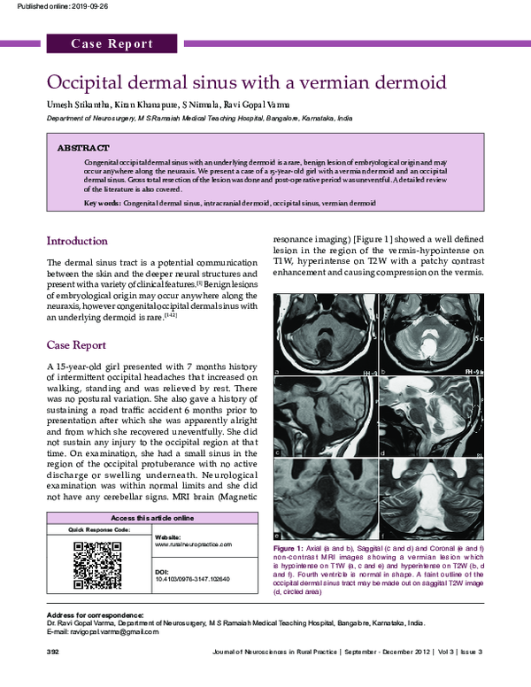 (PDF) Occipital dermal sinus with a vermian dermoid
