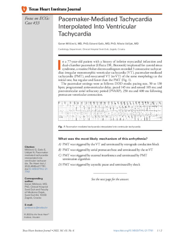 (PDF) Pacemaker-Mediated Tachycardia Interpolated Into Ventricular ...