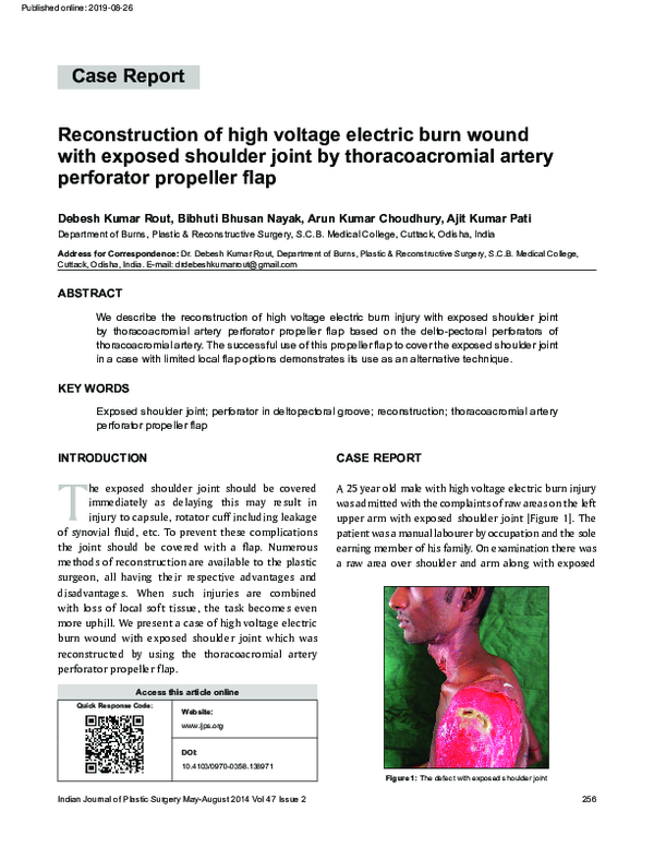 (PDF) Reconstruction of high voltage electric burn wound with exposed ...