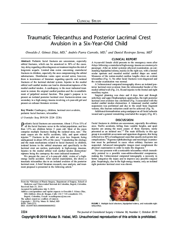 (PDF) Traumatic Telecanthus and Posterior Lacrimal Crest Avulsion in a ...