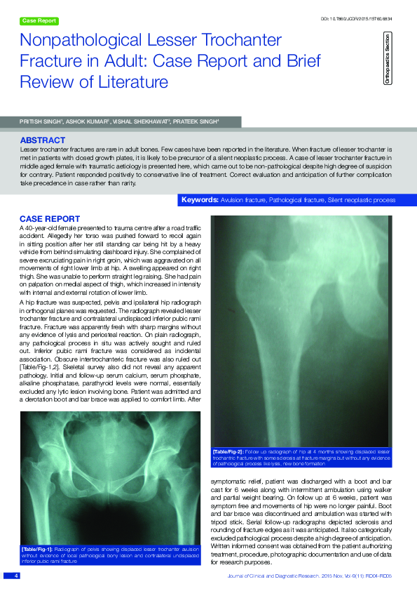 (PDF) Nonpathological Lesser Trochanter Fracture in Adult: Case Report ...