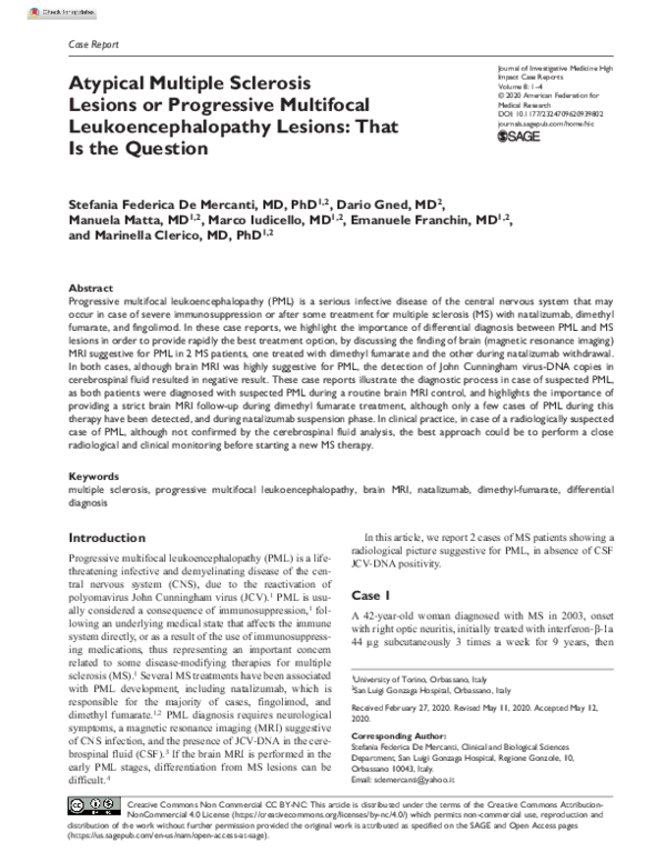 (PDF) Atypical Multiple Sclerosis Lesions or Progressive Multifocal Leukoencephalopathy Lesions ...