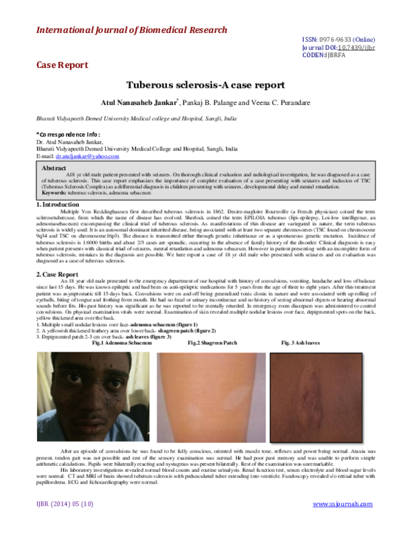 (PDF) Tuberous Sclerosis-A Case Report | Veena Purandare - Academia.edu
