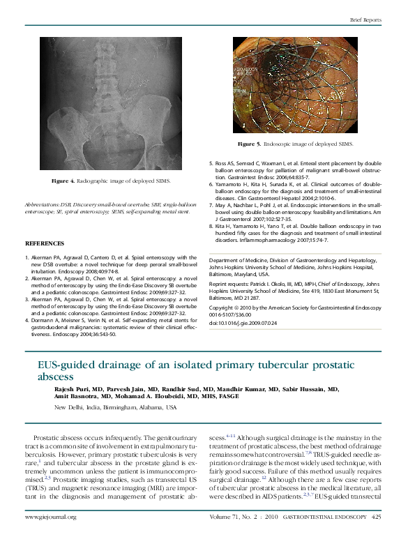 (PDF) EUS-guided drainage of an isolated primary tubercular prostatic abscess