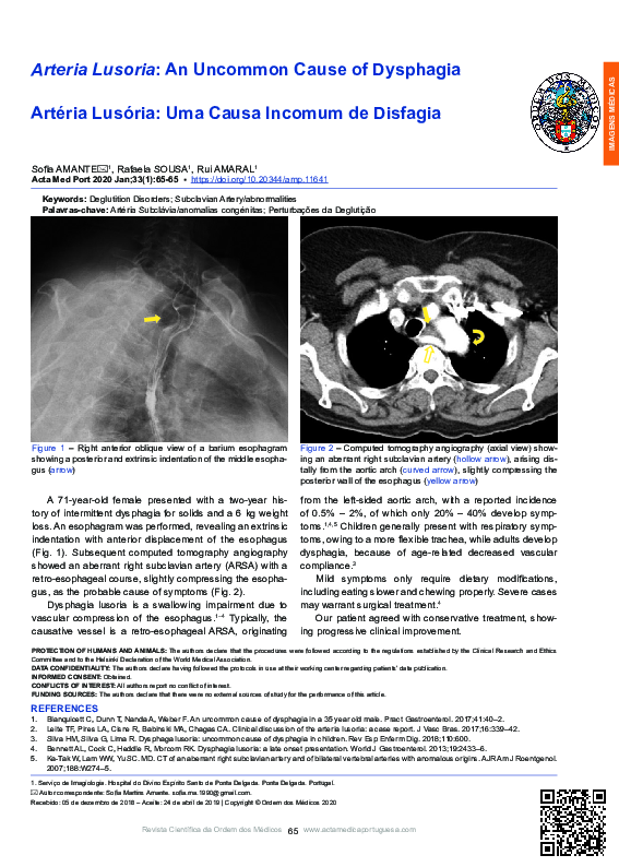 Arteria Lusoria: A Rare Cause Of Chronic Dysphagia – HZBCI