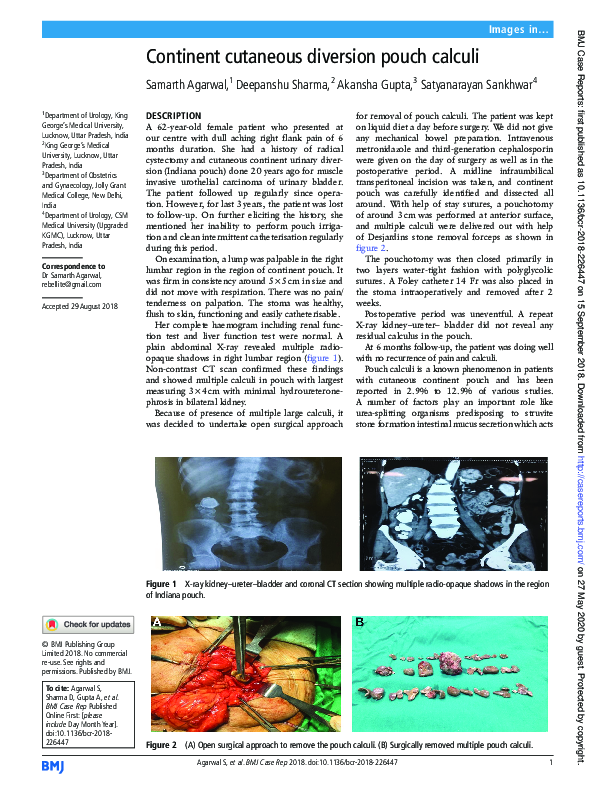 (PDF) Continent cutaneous diversion pouch calculi