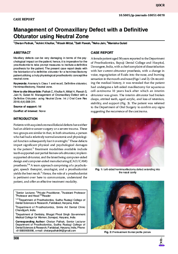 (PDF) Management of Oromaxillary Defect with a Definitive Obturator ...