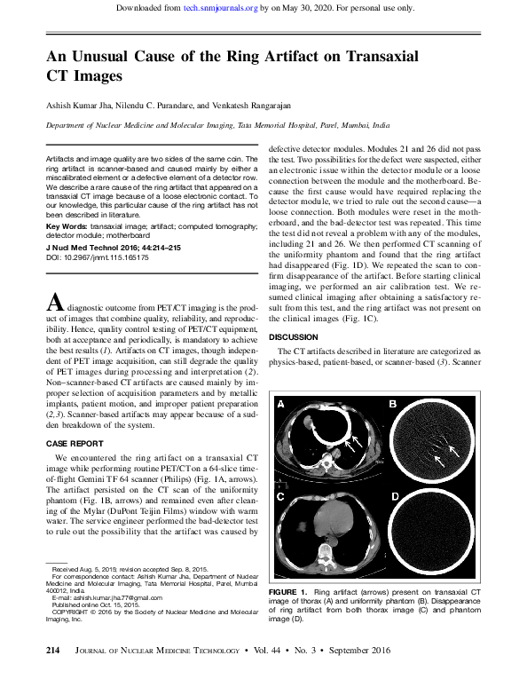 (PDF) Ring artifact in transaxial images of computed tomography- an ...