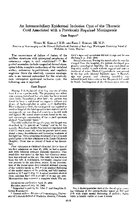 (PDF) An Intramedullary Epidermal Inclusion Cyst of the Thoracic Cord ...