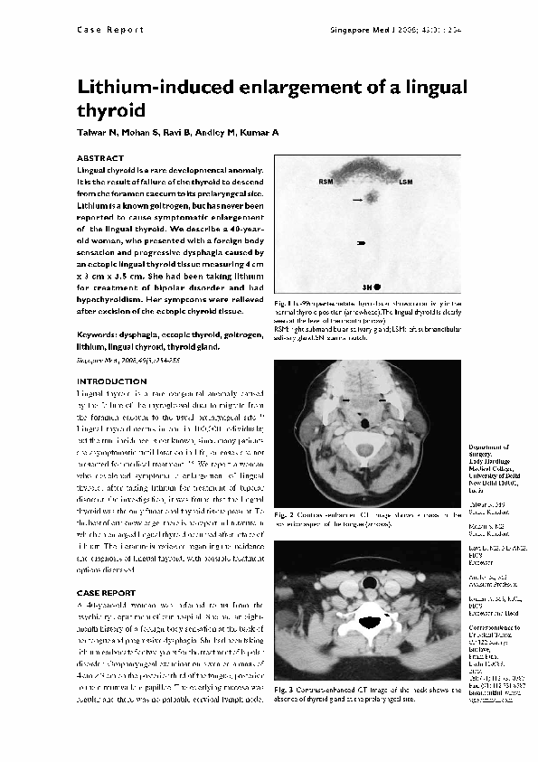(PDF) Lithium-induced enlargement of a lingual thyroid