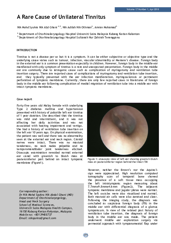 (PDF) A Rare Cause of Unilateral Tinnitus