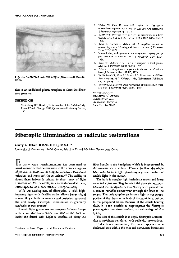 (PDF) Fiberoptic illumination in radicular restorations