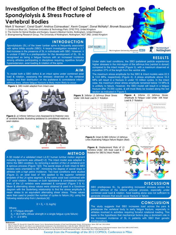 (PDF) Investigation of the Effect of Spinal Defects on Spondylolysis ...