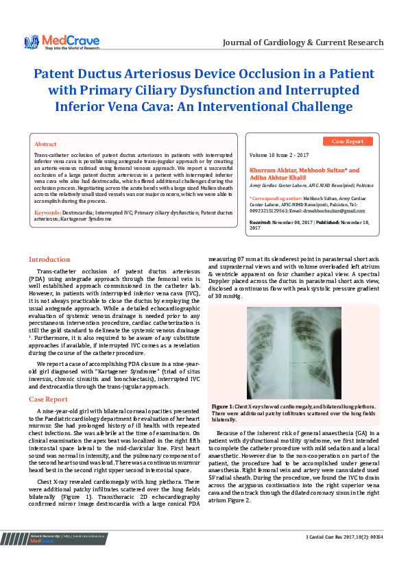 (PDF) Patent Ductus Arteriosus Device Occlusion in a Patient with ...