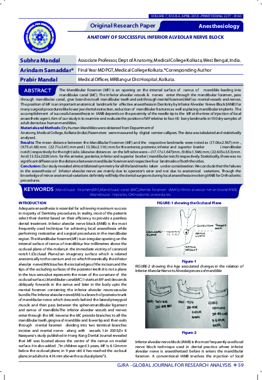 (PDF) Anatomy of successful inferior alveolar nerve block