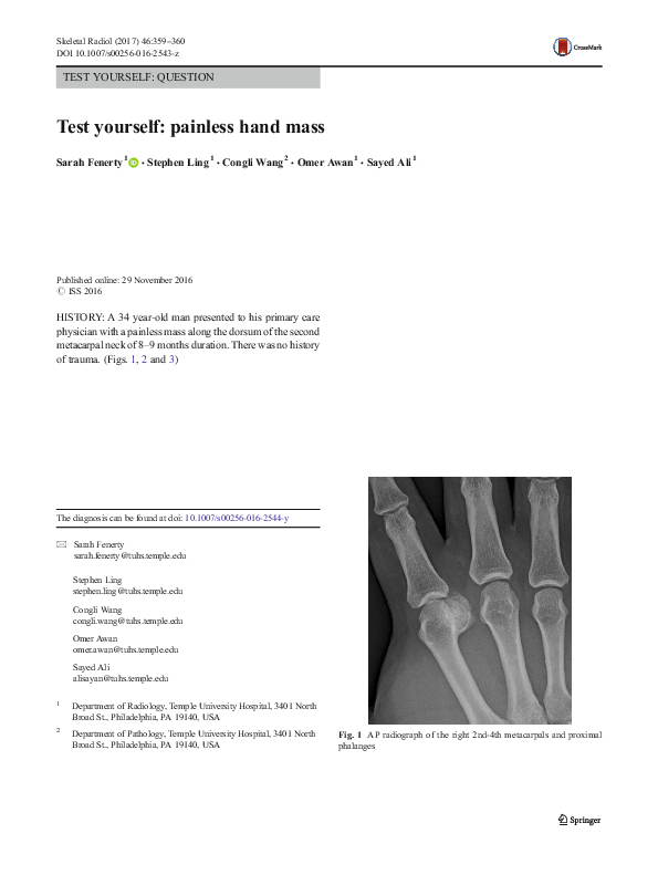 (PDF) Test yourself: painless hand mass