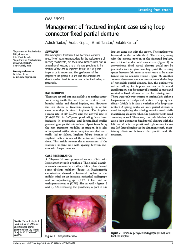 (PDF) Management of fractured implant case using loop connector fixed ...