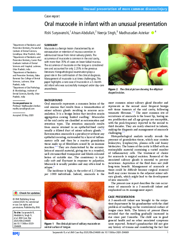 (PDF) Oral mucocele in infant with an unusual presentation