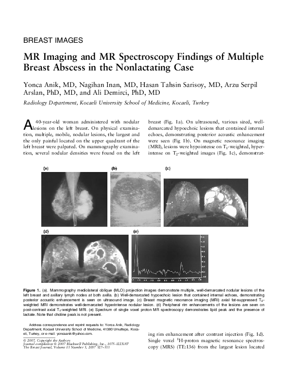 (PDF) MR Imaging and MR Spectroscopy Findings of Multiple Breast Abscess in the Nonlactating ...