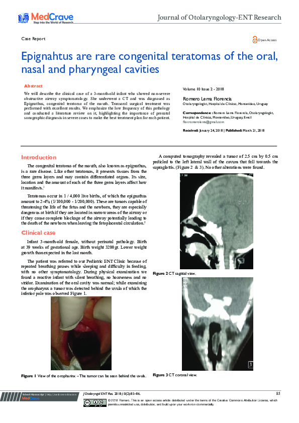 (PDF) Epignahtus are rare congenital teratomas of the oral, nasal and ...