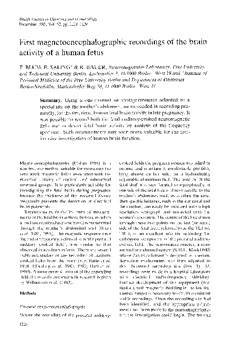 (PDF) First magnetoencephalographic recordings of the brain activity of ...